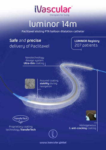 Luminor 14M Paklitaksel Salınımlı PTA Balon Dilatasyon Kateteri ...